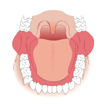 Oral cancer awareness - Abbots Lodge